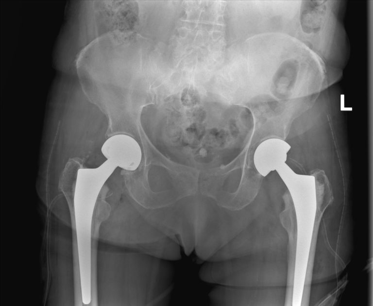 Oberschenkel – mySurgery