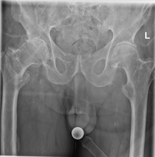 Oberschenkel – mySurgery