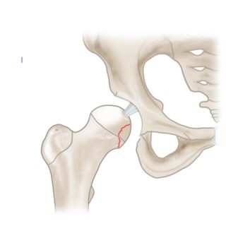 mySurgery | Oberschenkel