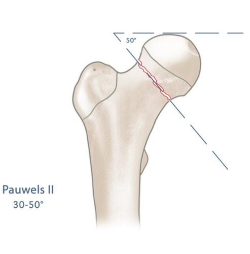 Oberschenkel – mySurgery