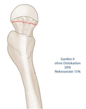 Oberschenkel – mySurgery