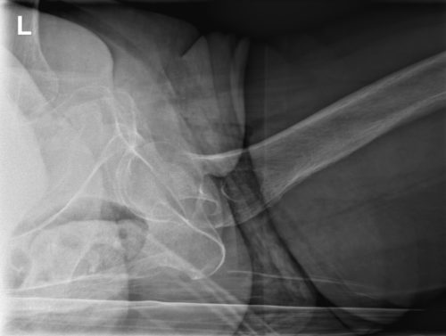 Oberschenkel – mySurgery