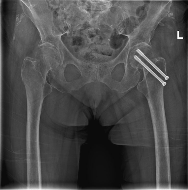 Oberschenkel – mySurgery