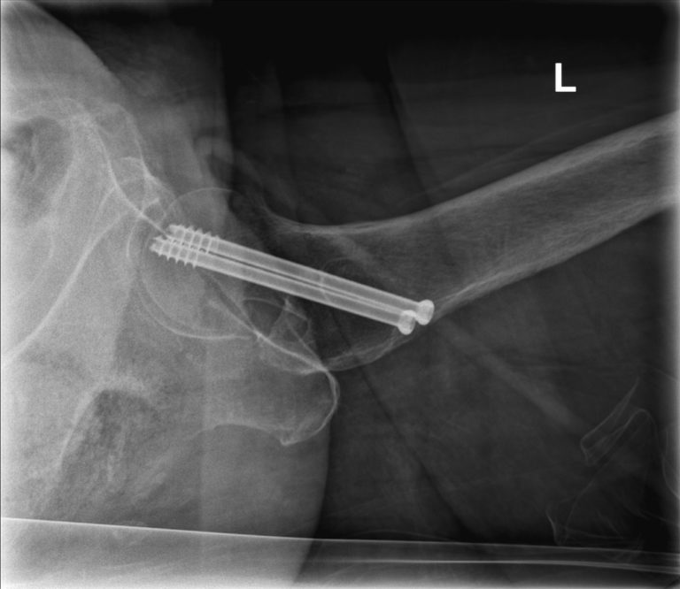 mySurgery | Oberschenkel