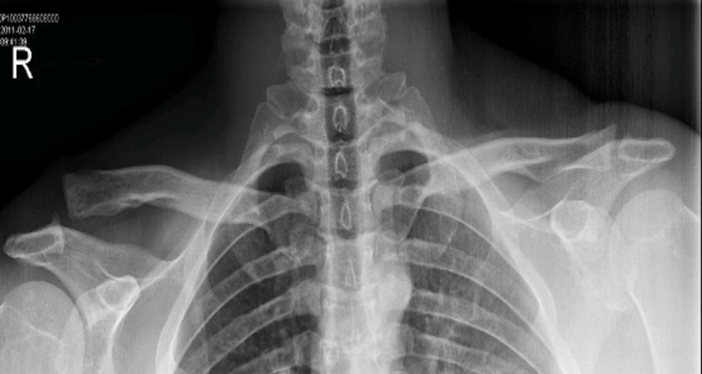 Schultergürtel – mySurgery