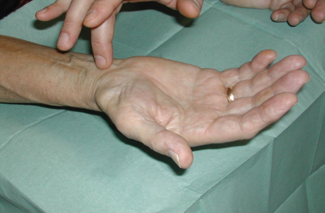 Differenzialdiagnose chronischer Handgelenksschmerzen – mySurgery