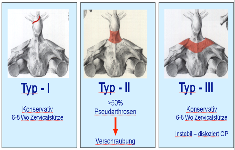 Wirbelsäule 1 – mySurgery
